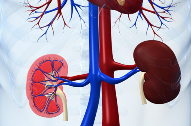 Cancer du rein - Planete sante