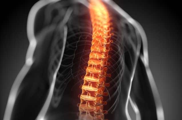 Myélome multiple (plasmocytome) - Planete sante