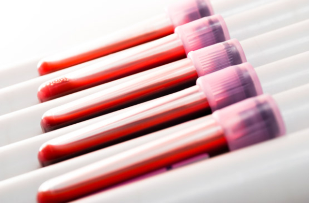 L’ABC des groupes sanguins - Planete sante