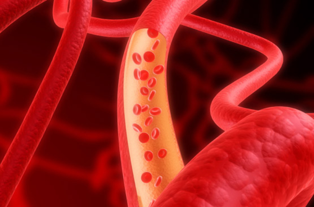 Maladie coronarienne, quels examens pour la diagnostiquer? - Planete sante