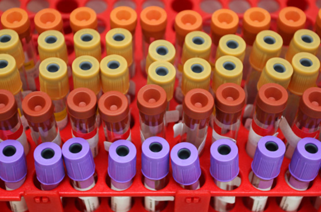 Leucémies (cancer du sang) - Planete sante