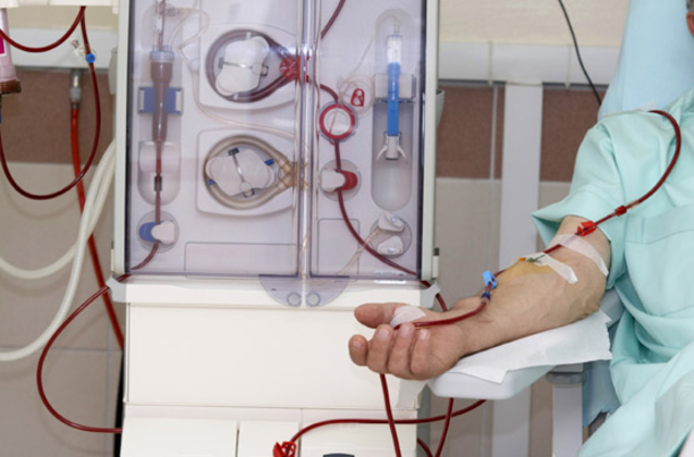 Dialyse: un principe simple, une invention tardive et des questions ...