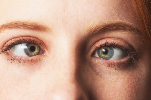 Le strabisme - Planete sante