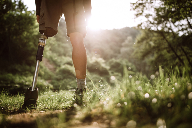 Une prothèse de jambe sensitive - Planete sante